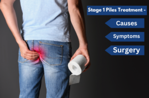 Stage 1 Piles Treatment - Causes, Symptoms, and Surgery - Digestive ...